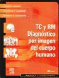 Buy Tomografia Computadorizada Y Resonancia Magnetica Del Cuerpo Humano ...