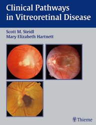 Buy Clinical Pathways In Vitreoretinal Disease book : Mary Elizabeth ...