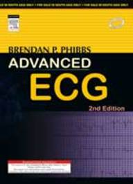 Buy Advanced Ecg: Boards And Beyond, 2/E book : Brendan Phibbs ...