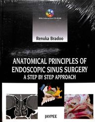 Buy Anatomical Principles Of Endoscopic Sinus Surgery W/Cd : A Step By ...
