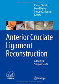 Buy Anterior Cruciate Ligament Reconstruction: A Practical Surgical ...