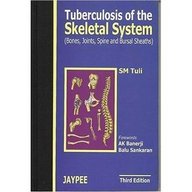 Buy Tuberculosis Of The Skeletal System - (Bones, Joints, Spine And ...