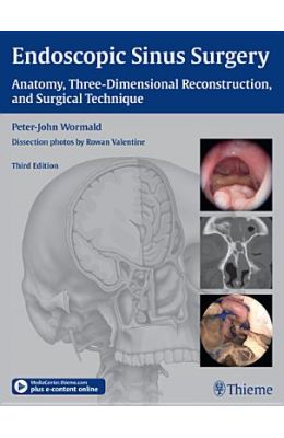 Buy Endoscopic Sinus Surgery: Anatomy, Three-Dimensional Reconstruction ...