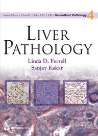 Buy Liver Pathology (Consultant Pathology) book : Linda Ferrell,Sanjay ...