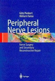 Buy Peripheral Nerve Lesions: Nerve Surgery And Secondary ...