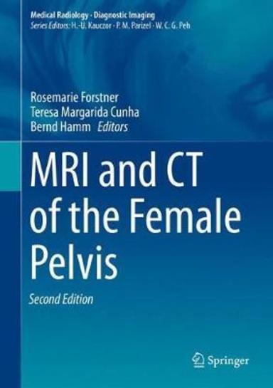 Buy MRI and CT of The Female Pelvis: 2nd Edition book : Rosemarie ...