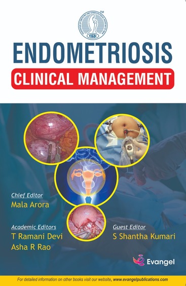 Buy Endometriosis Clinical Management book : Mala Arora, T Ramani Devi ...
