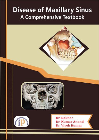 Buy Disease of Maxillary Sinus - A Comprehensive Textbook book : Rakhee ...