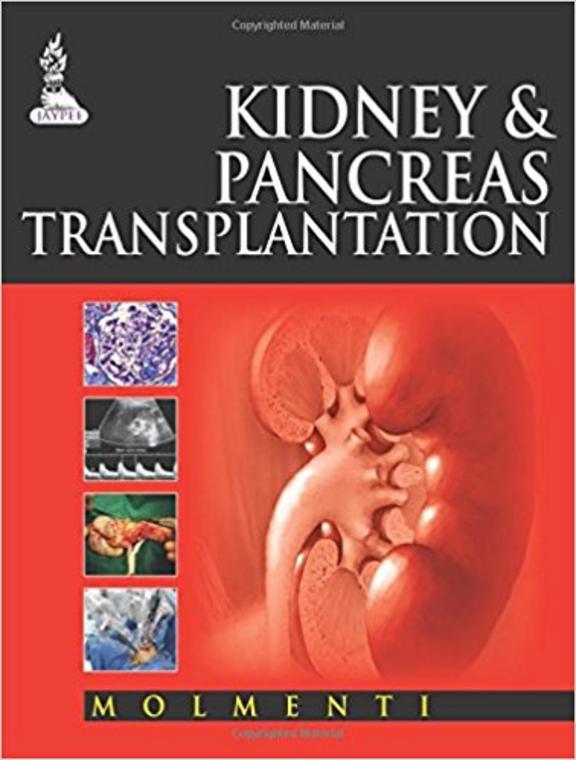 Buy Kidney and Pancreas Transplantation book : Molmenti , 935152339X ...
