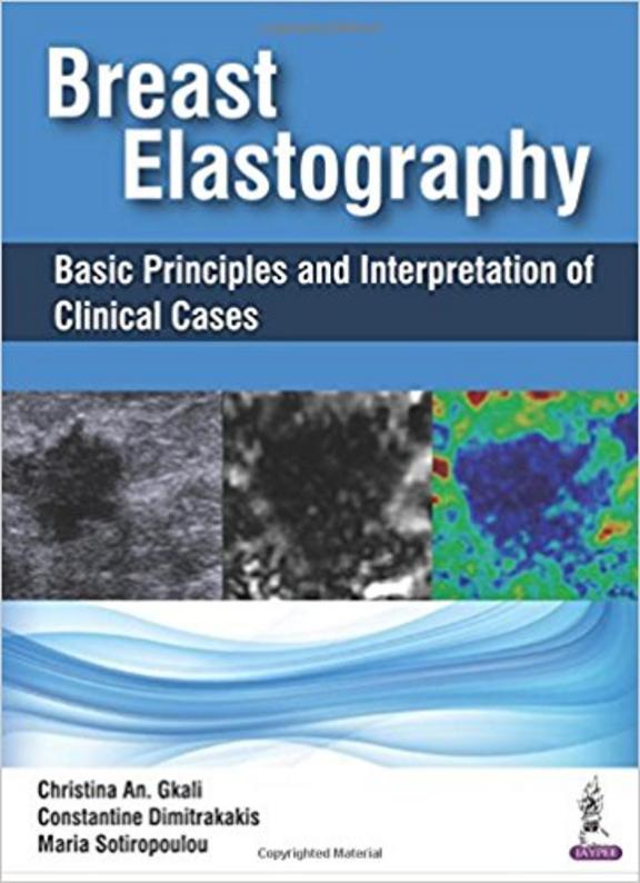Buy Breast Elastography Basic Principles And Interpretation Of Clinical ...