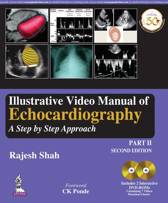 Buy Illustrative Video Manual of Echocardiography: A Step by Step ...