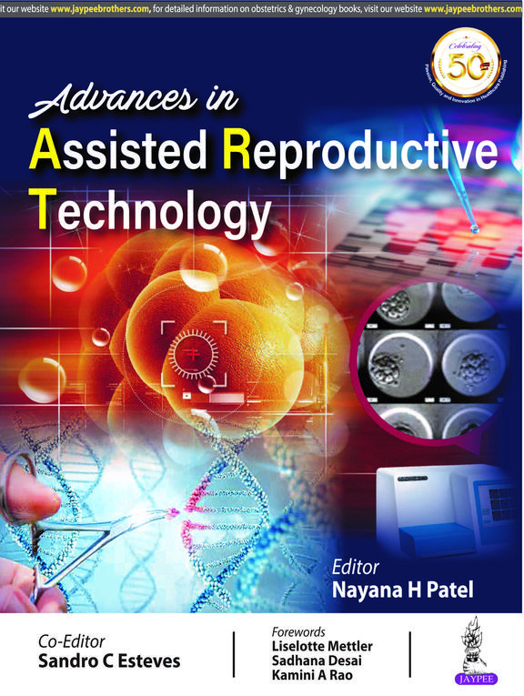 Buy Advances In Assisted Reproductive Technology book : Nayana H Patel ...